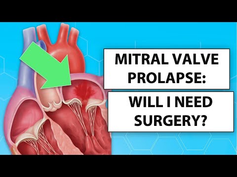 Mitral Valve Prolapse: Will I Need Heart Surgery?