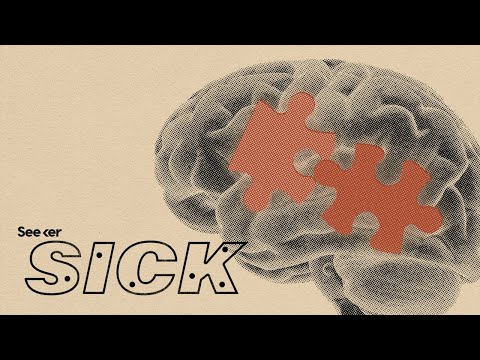 What Does Alzheimer’s Do to the Human Brain?