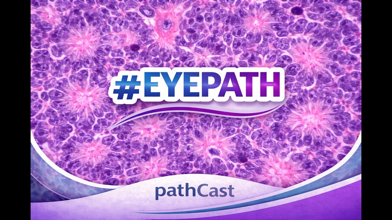 #EYEPATH Approach to the Anterior Eye - Cornea and Conjunctiva