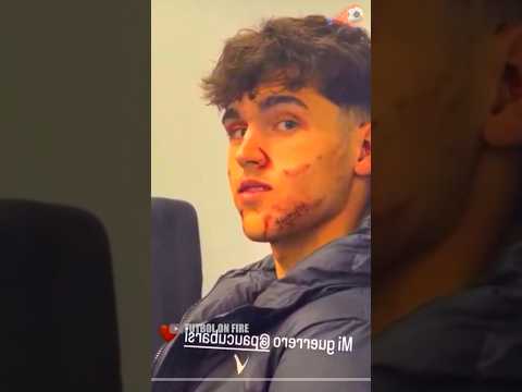 Así le quedó la cara a Pau Cubarsí tras jugar Champions con el Barcelona #futbol #barcelona #shorts