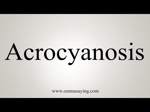How To Say Acrocyanosis