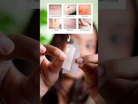 Remove Scar using this 😱‼️ #scarremoval #acnescars #scars