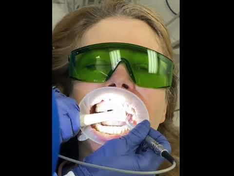 Laser Bacterial Reduction (LBR). Real time 5 minutes!