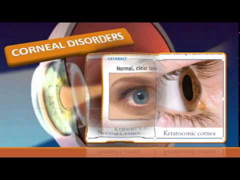 Care of Patients with Eye & Vision Disorders