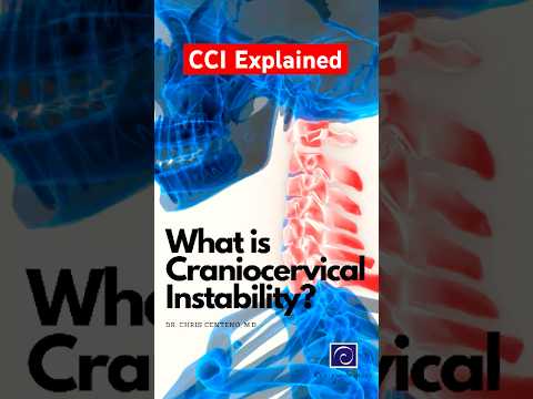 What is CCI? - Dr Centeno Answers Ep.1