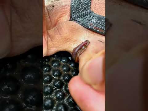 leeches bite  🤢🤮 #leech #wildlife #shorts