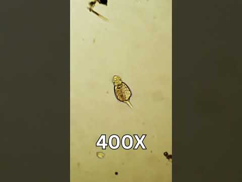 Microbes in our nails under microscope | Dust and Germs in nails - 400x Microscopic View