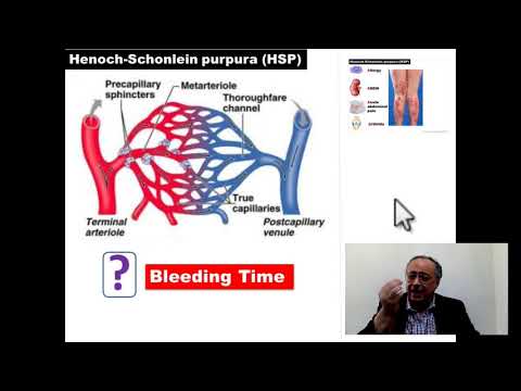 Henoch-Schonlein purpura #cme #internal_medicine #medical #pharmaceutical #doctor #محاضرات_باطنة