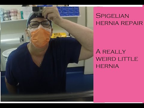 A Spigelian Hernia - It is the coolest lump around?