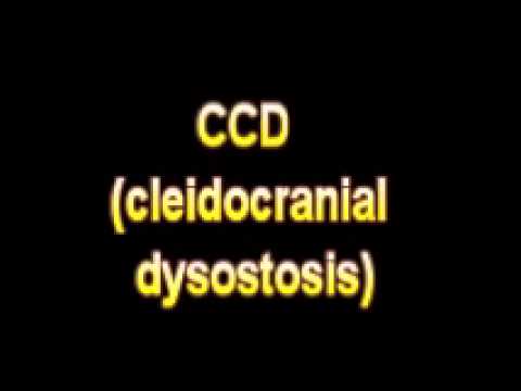 What Is The Definition Of CCD cleidocranial dysostosis Medical Dictionary Free Online