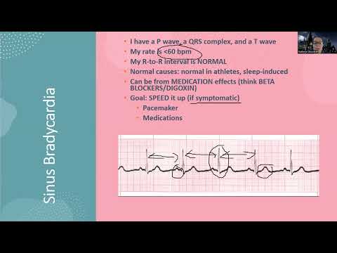 Adult Med/Surg: Dysrhythmia NEW Lecture Sinus Bradycardia