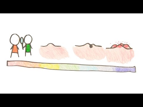 Cause Of Acne Pimples During Puberty Video Lecture Class 8