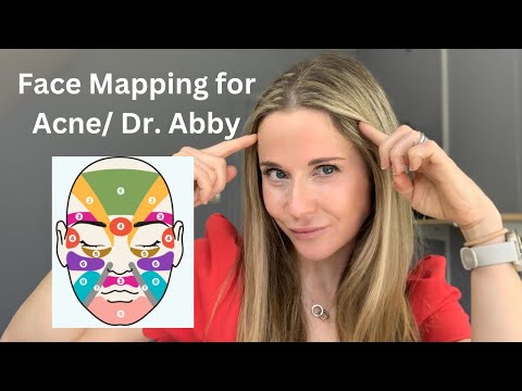 Face Mapping for Acne. The location of your breakouts can tell you a lot/ Dr. Abby