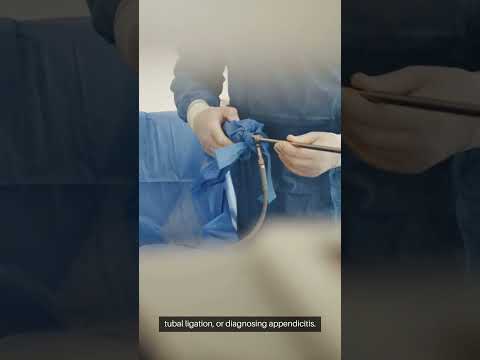 Laparoscopy Explained