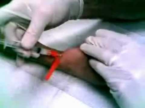 CMC joint injection