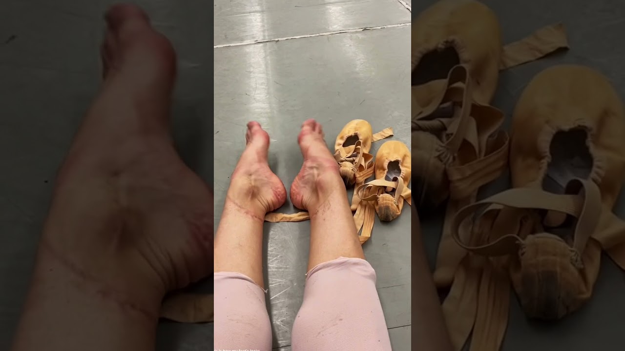 Ballerina feet after 4 hrs dancing || ballet dance challenge || flexibility and gymnastics