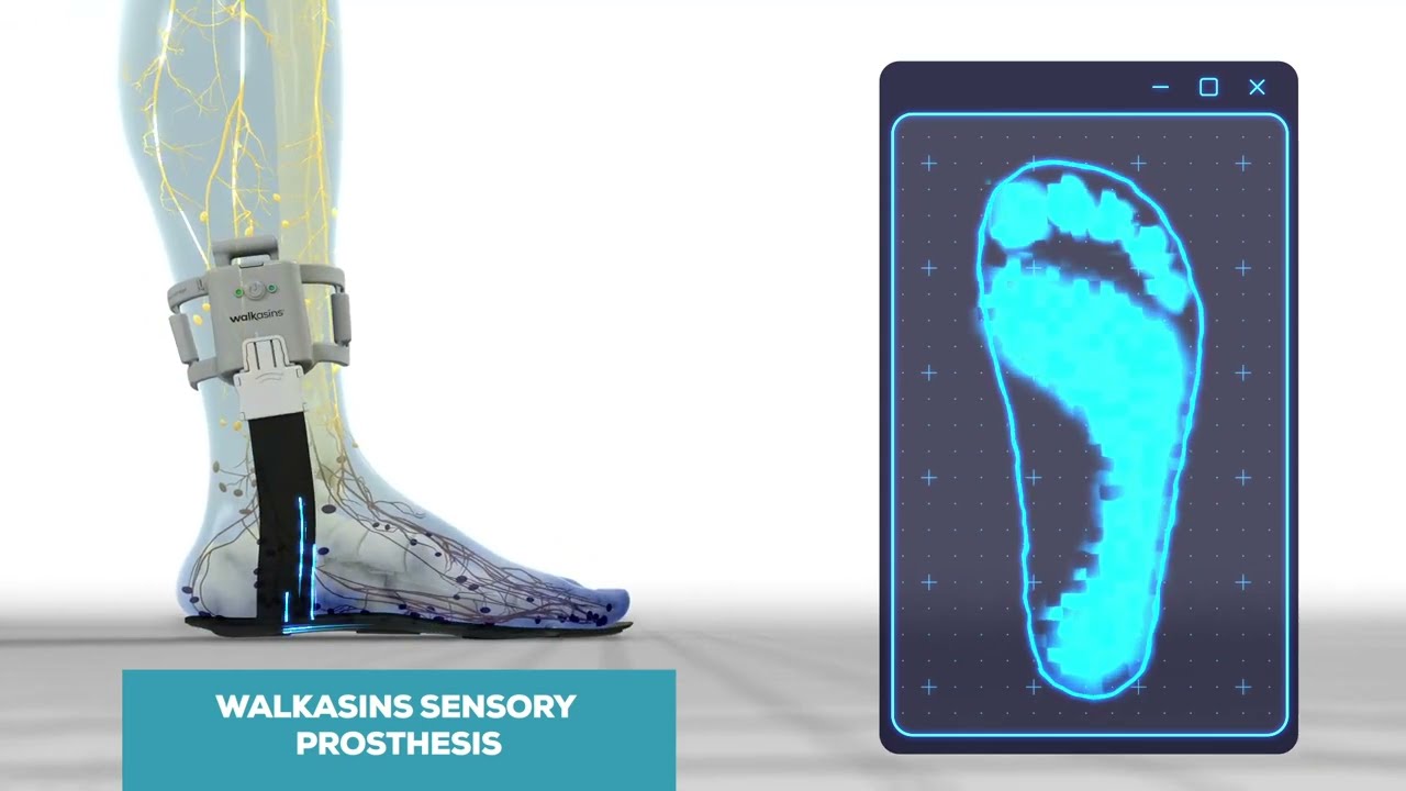 Walkasins: Restoring Balance in People with Peripheral Neuropathy.