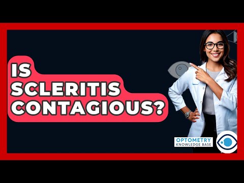 Apakah Skleritis Menular? - Basis Pengetahuan Optometri