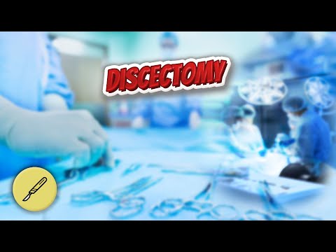 Discectomy - Everything Surgeries ✅😬⁉️