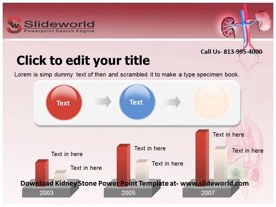 Kidney Stone Powerpoint Template