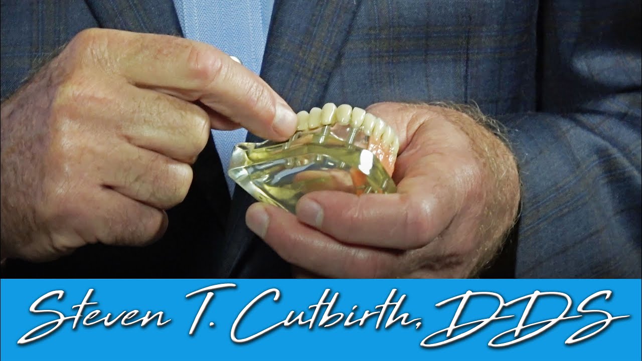What is a Dental Implant - Dental Minute with Steven T. Cutbirth, DDS