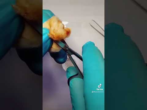 Cigarette filter before and after use!