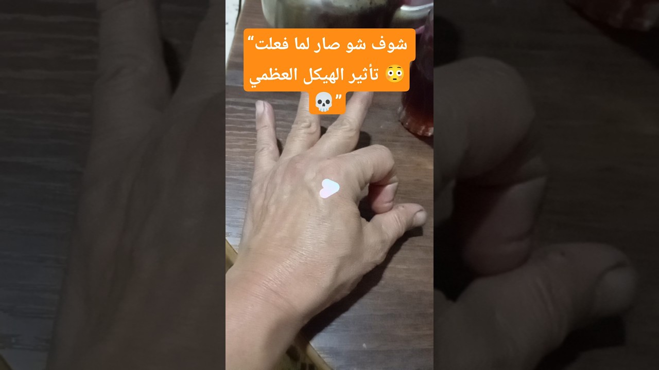 🎯 “AI Turned My Hand Into a