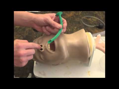 Inserting a NPA (nose hose)