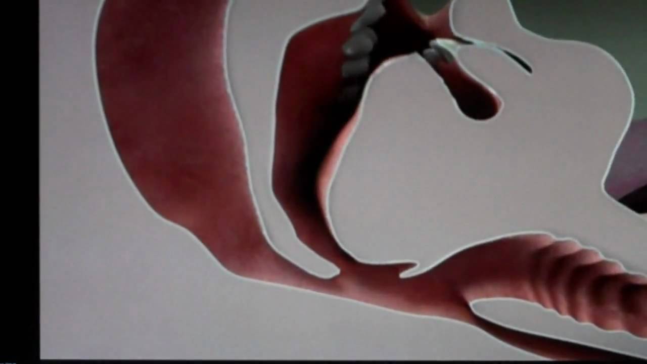 Sleep Apnea the silent killer.  Dental treatment for this problem in Shelby, Michigan