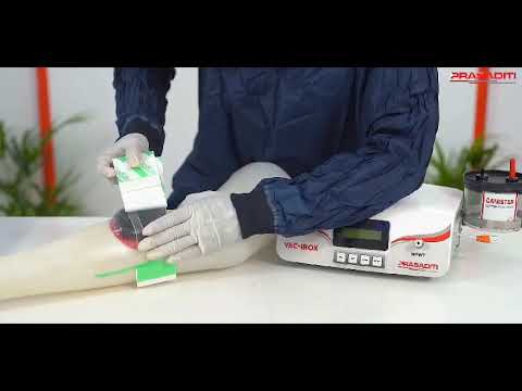 Negative Pressure Wound Therapy, Negative Pressure Wound Therapy ...