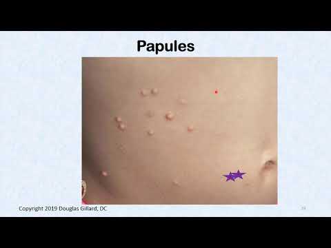 Dermatology (SPR 20) (WK2): The Language of Dermatology, Lentigo, and Melasma.