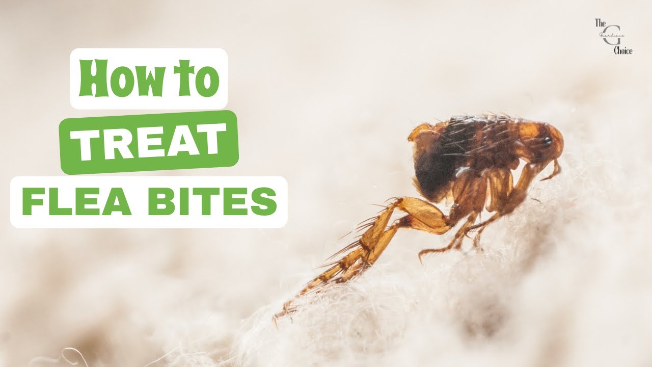 How to Treat Flea Bites Instantly with These Simple Hacks!