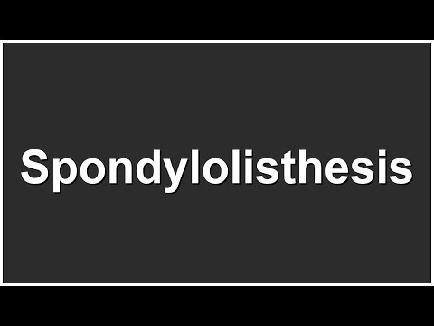 How to pronounce Spondylolisthesis
