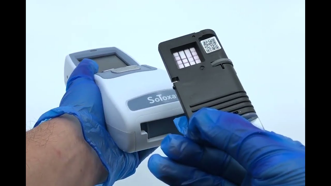 Abbott SoToxa : portable mobile rapid drug screening and detection in oral fluid