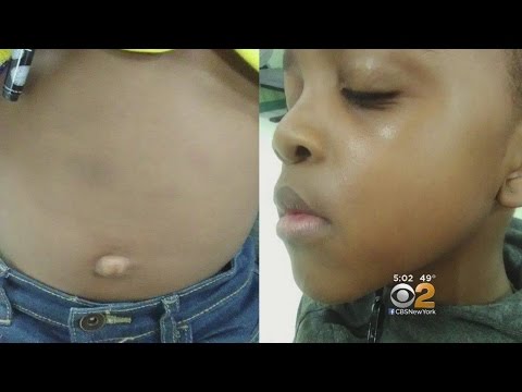 Brooklyn Principal Accused Of Assaulting Student