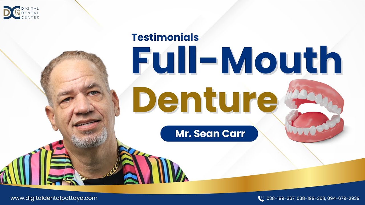 Full-Mouth Denture Transformation | Digital Dental Center Pattaya