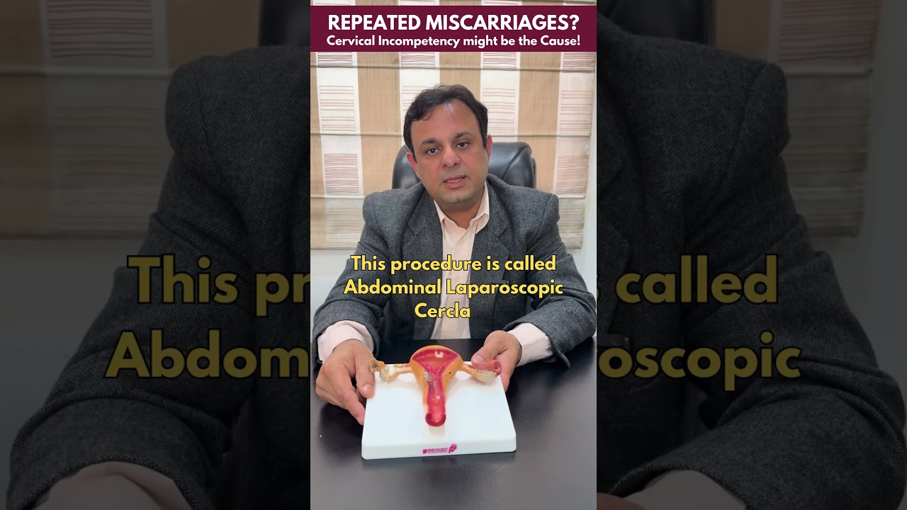 REPEATED MISCARRIAGES?  CAUSE - INCOMPETANCY - SOLUTION  ABDOMINAL LAPAROSCOPIC CERCLAGE