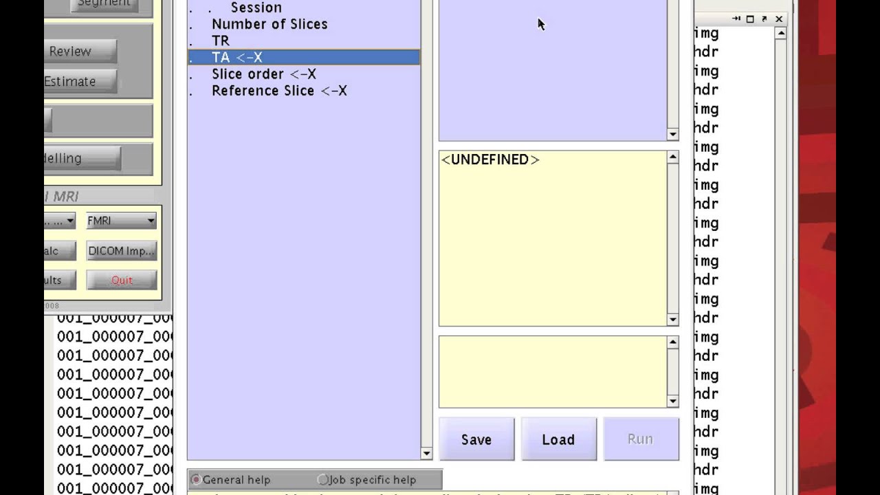 SPM Slice Timing Correction: GUI