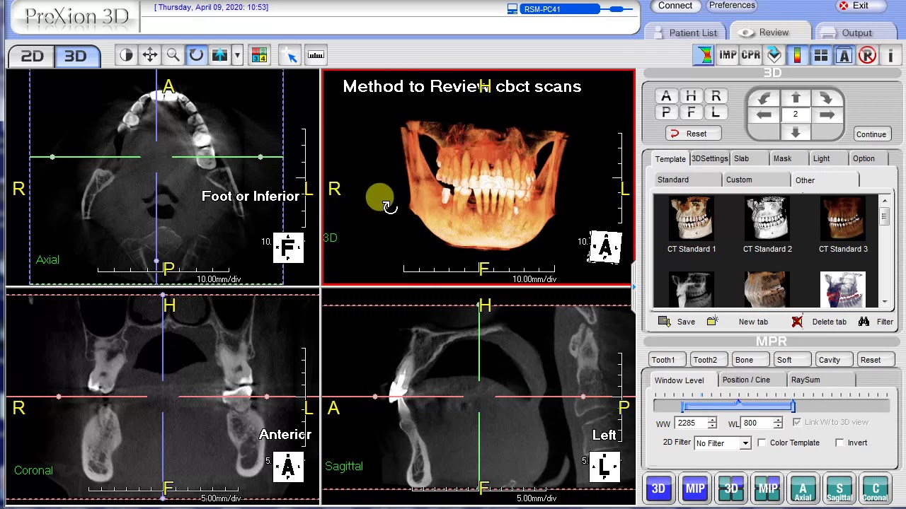 PreXion Training Tips: CBCT Review Methodology
