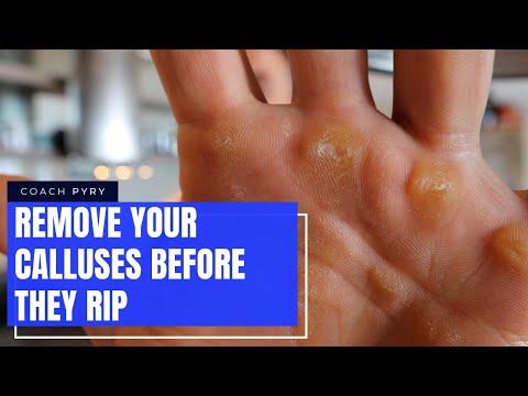 Hand Care For Lifters - Stop Tearing Your Calluses