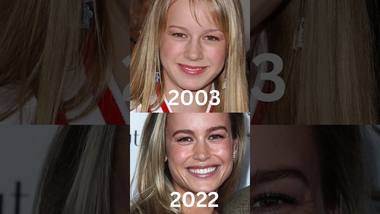 Brie Larson plastic surgery transformation