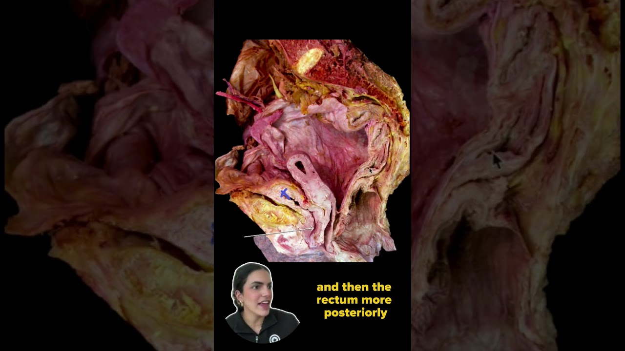 Anatomy of the Pelvis | Can you identify the tagged structure? | Med School Bootcamp
