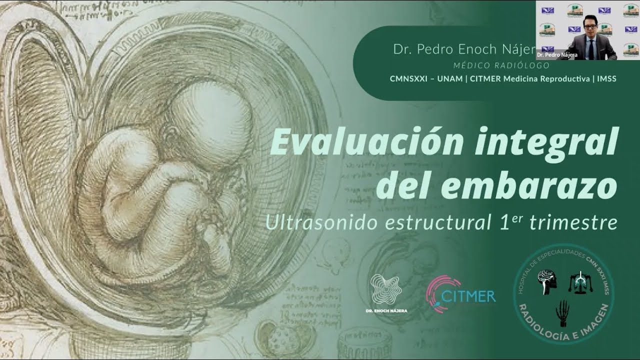 1 - 2 Ultrasonido estructural primer trimestre del embarazo | Dr. Najera
