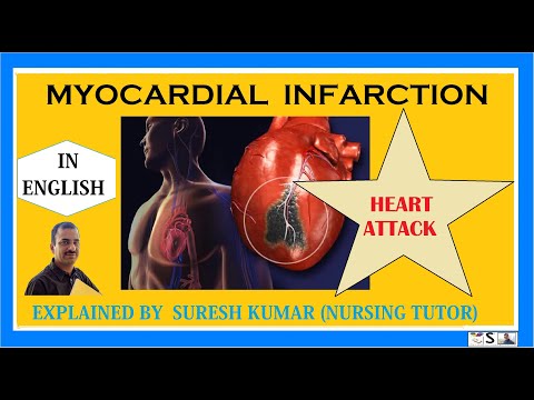 HEART ATTACK | MYOCARDIAL INFARCTION IN ENGLISH
