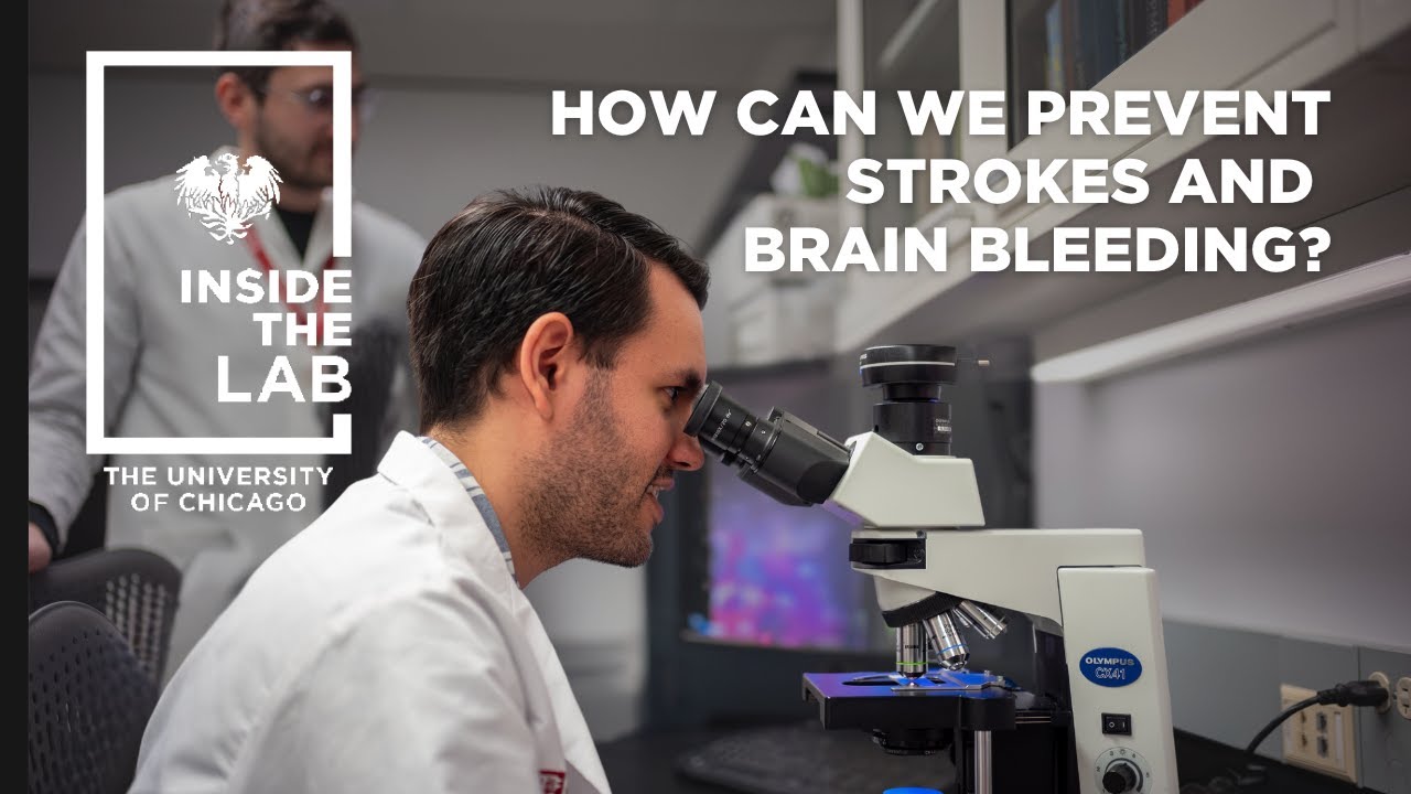 Awad Lab: Predicting and preventing strokes and brain bleeds | Inside the Lab