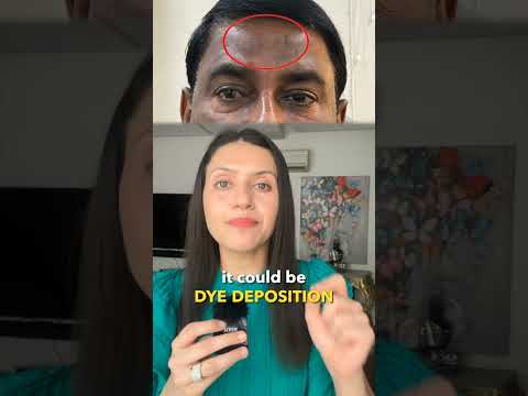 Got Forehead tan? || Dr. Jushya Sarin ||