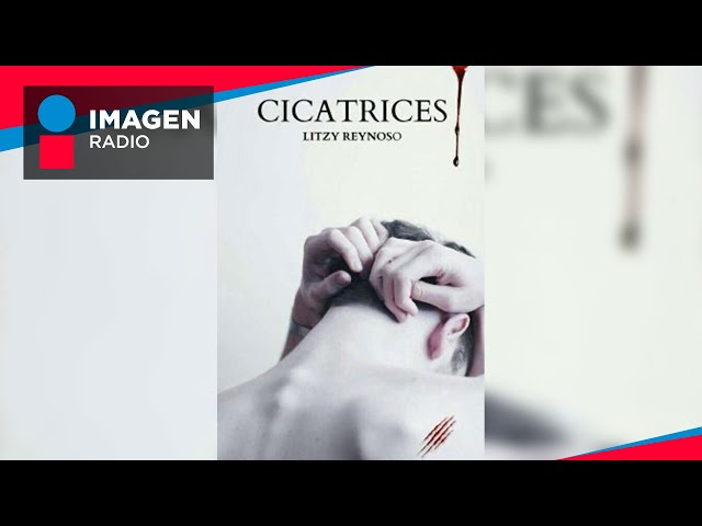 Litzy Reynoso, presenta su libro "Cicatrices"