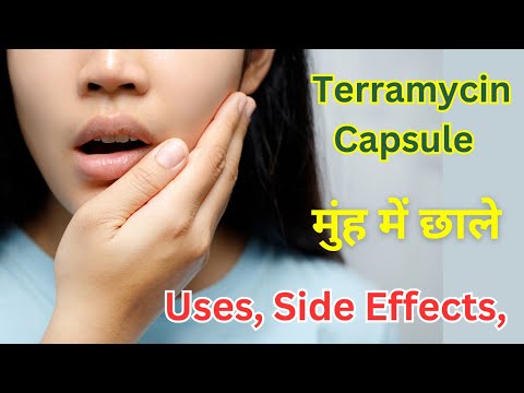Terramycin Infection Capsule, specification and features