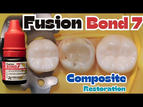 Dental Composite Kit - Flowable Composite kit Latest Price ...