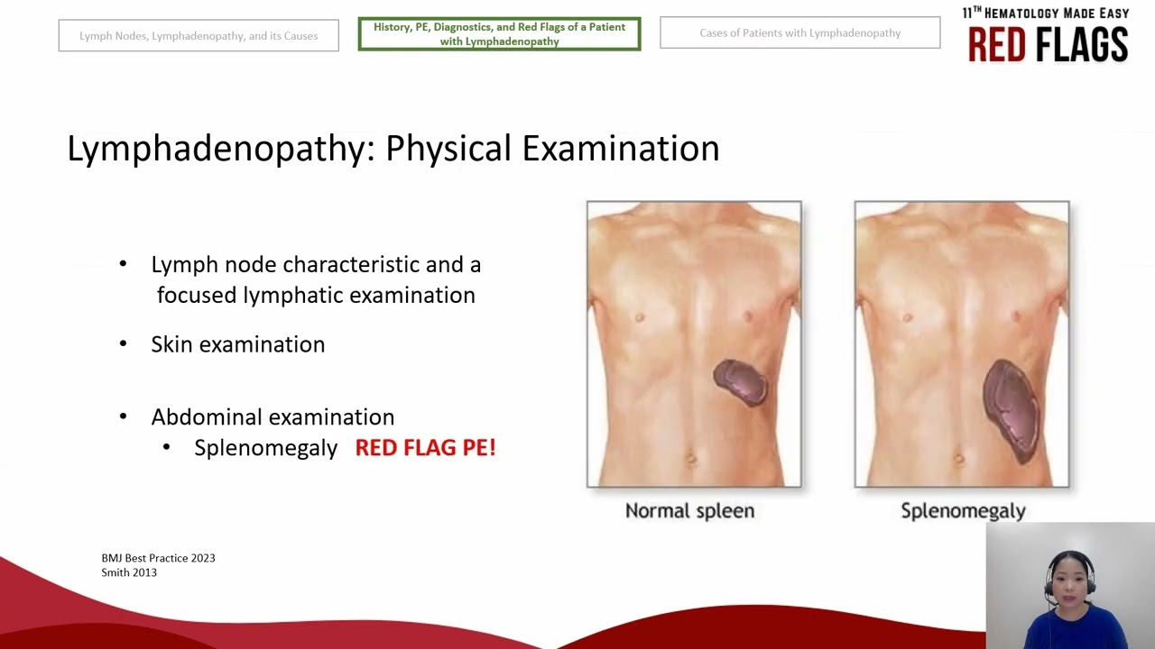 APPROACH TO PATIENT PRESENTING WITH ENLARGED LYMPH NODES